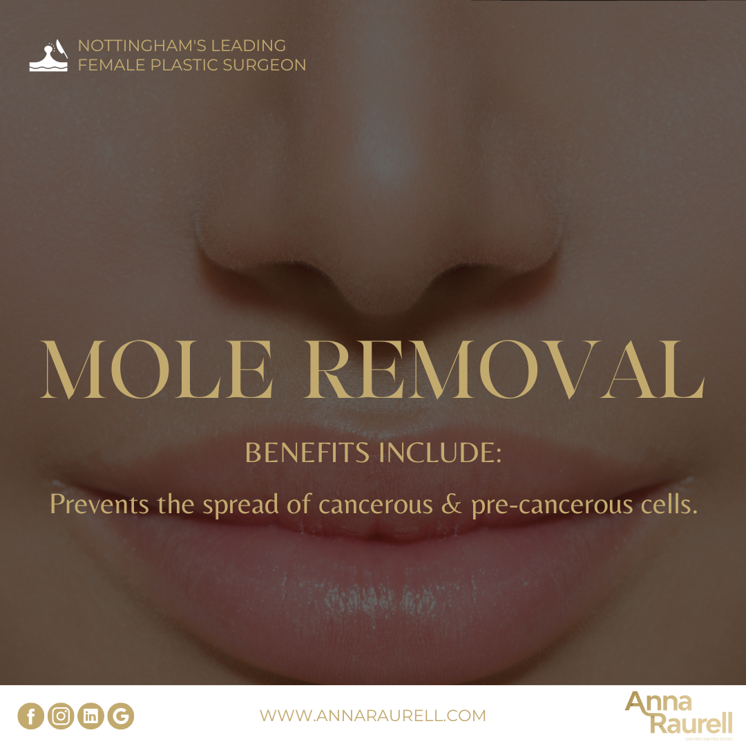 Mole removal post operative - Anna Raurell - Nottingham